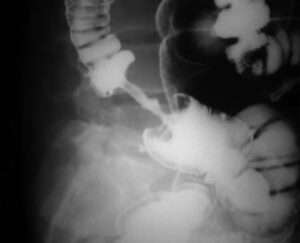 apple core sign | KINESIOPATIA