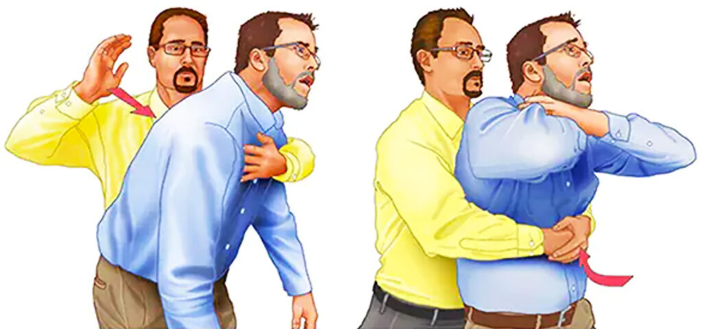 manovra di Heimlich | KINESIOPATIA